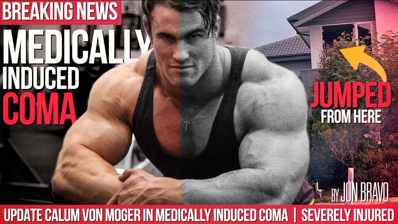 Calum Von Moger: In hospital| Bodybuilder| Net Worth| Family - sportsjone