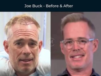 Joe Buck: Where did go to college| Did play sports| Hair transplant ...